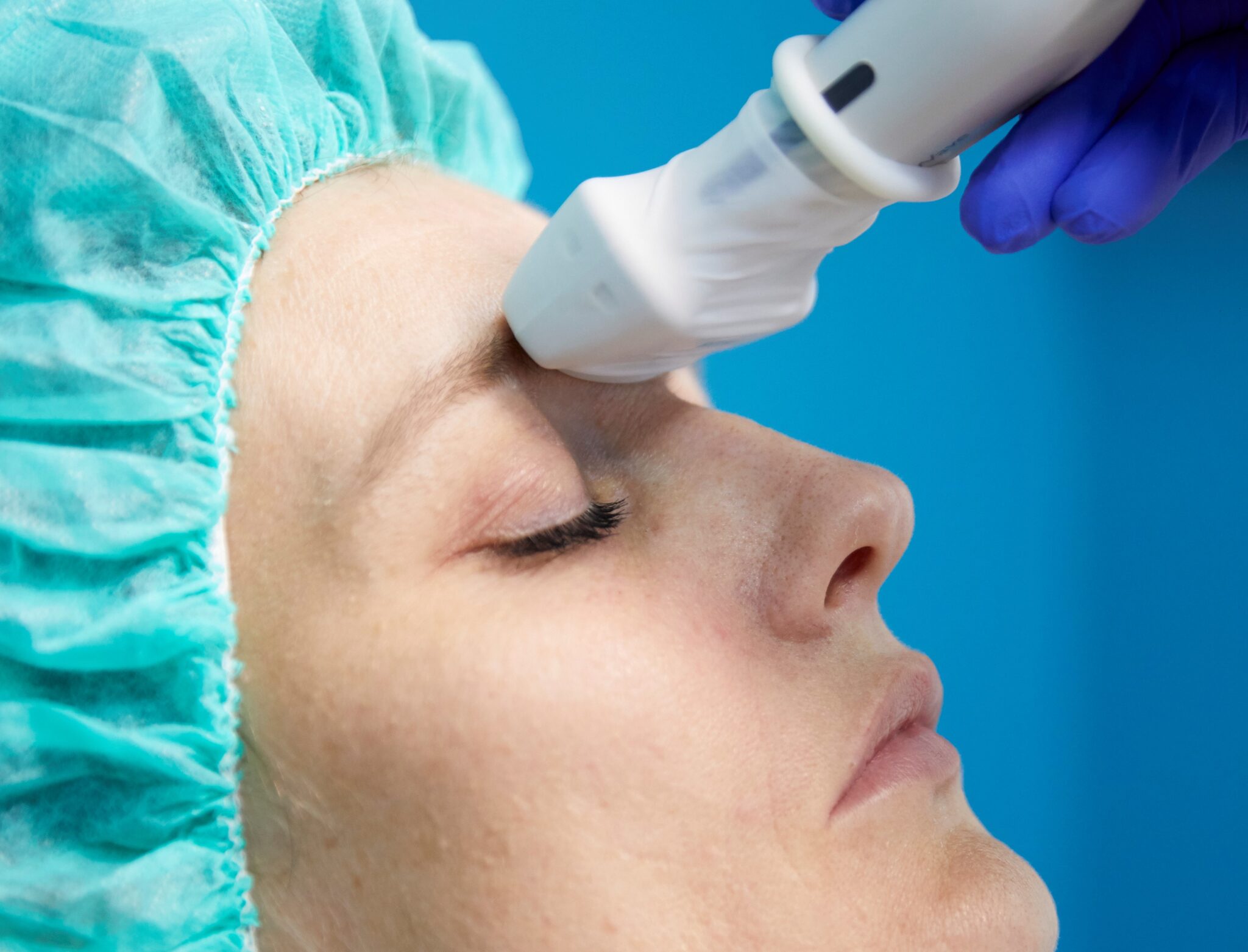 Academy anatomy forehead - Cutaneous