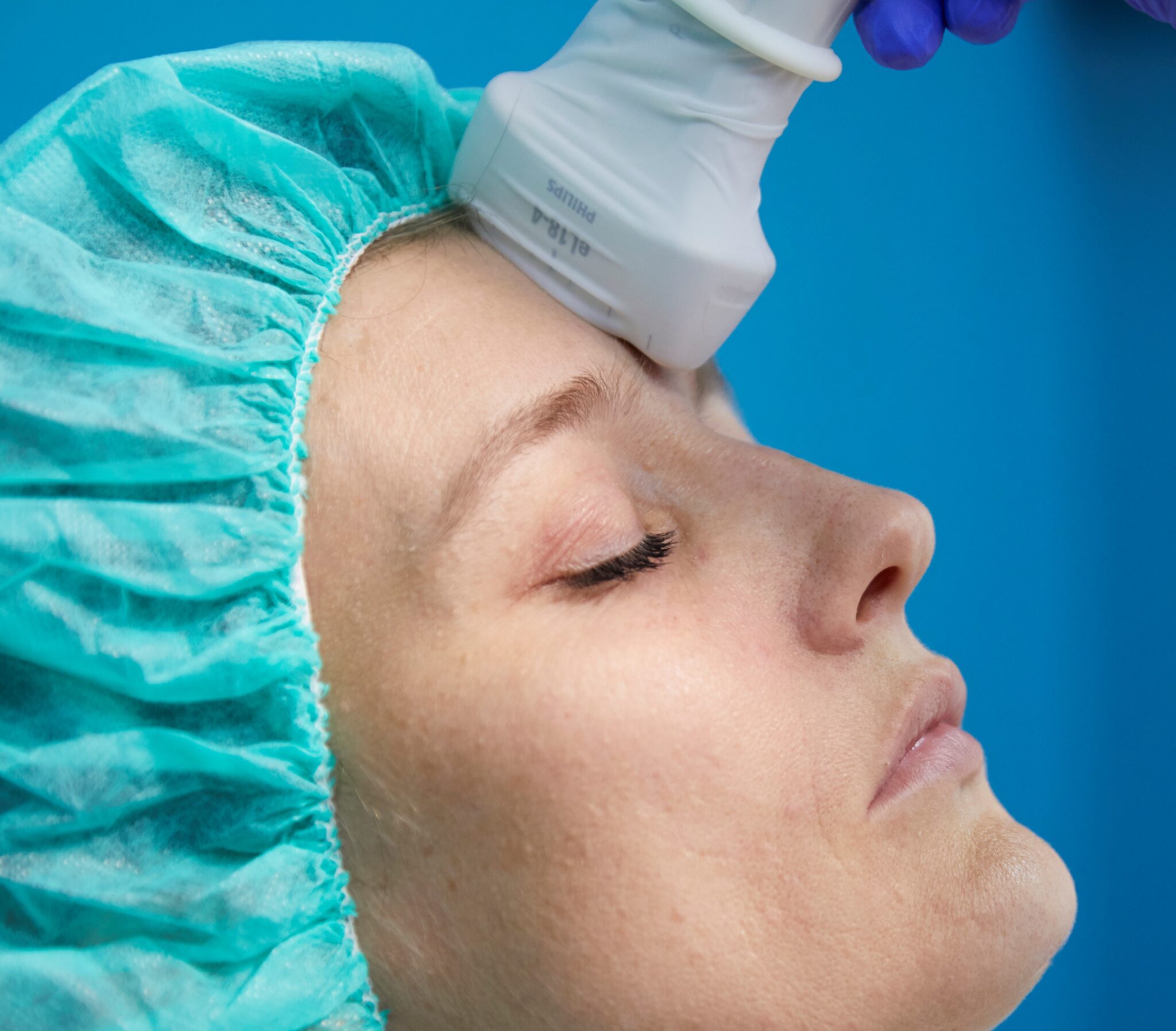 Academy anatomy forehead - Cutaneous