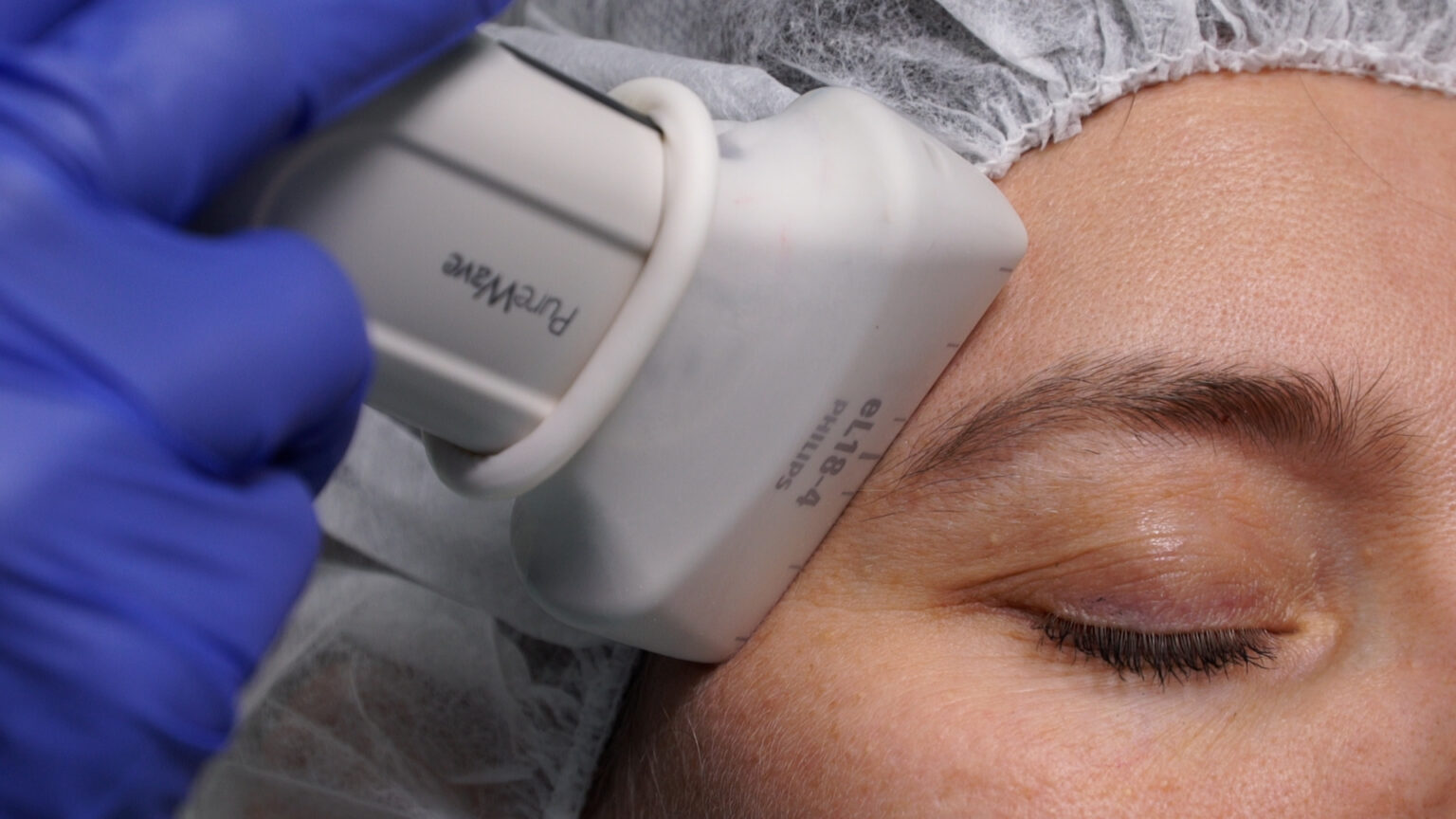 Academy anatomy temples - Cutaneous