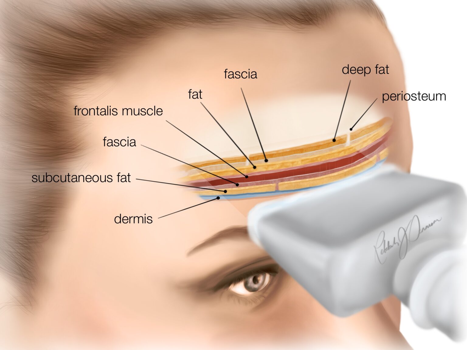 Academy anatomy forehead - Cutaneous