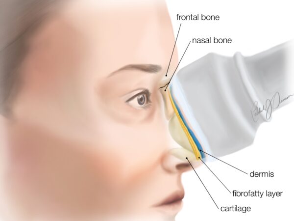 Academy anatomy nose - Cutaneous