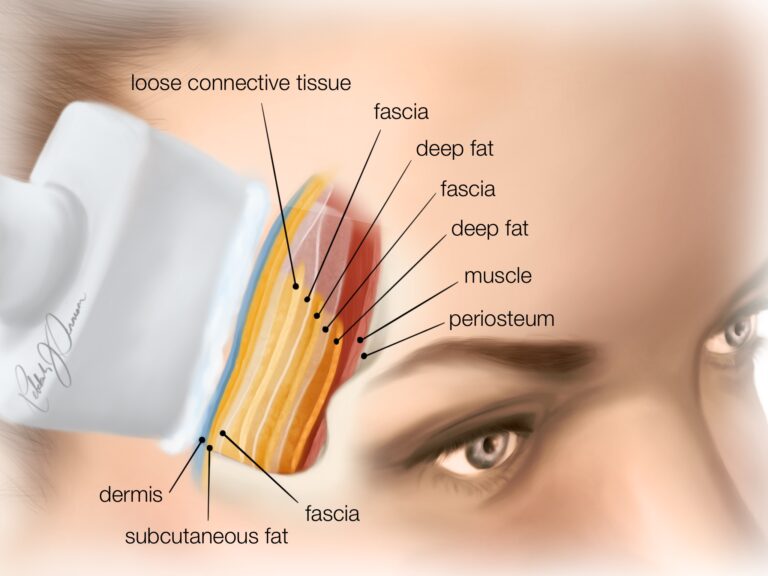 Academy anatomy temples - Cutaneous