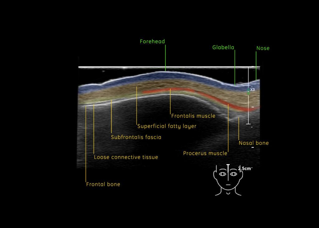 FH 01 - Cutaneous