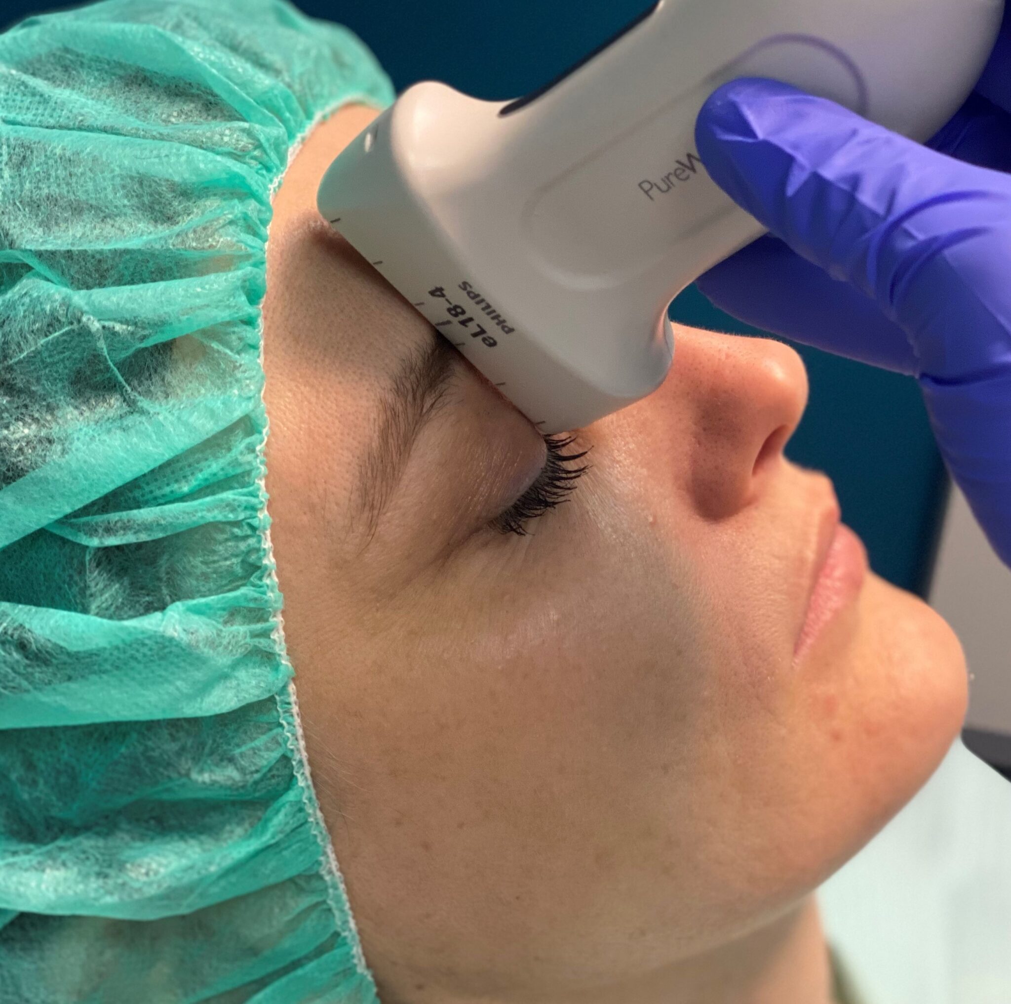 Academy anatomy forehead - Cutaneous